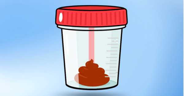 Did you know? What diseases can bloody stool indicate? | Ratchasima ...